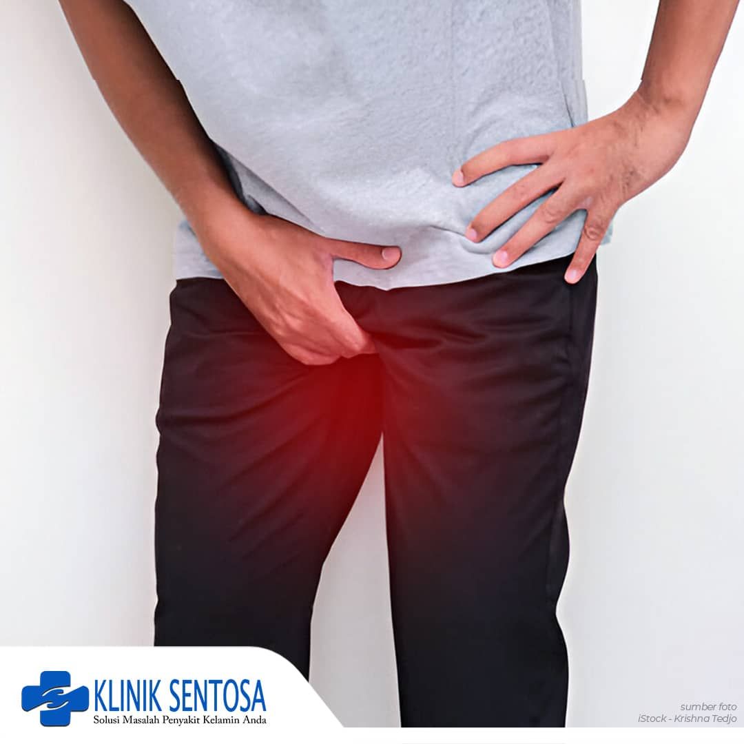 Penyebab Kemaluan Pria Lecet yuk Kenali dan Cegah! - Penyebab Kemaluan Pria Lecet yuk Kenali dan ...